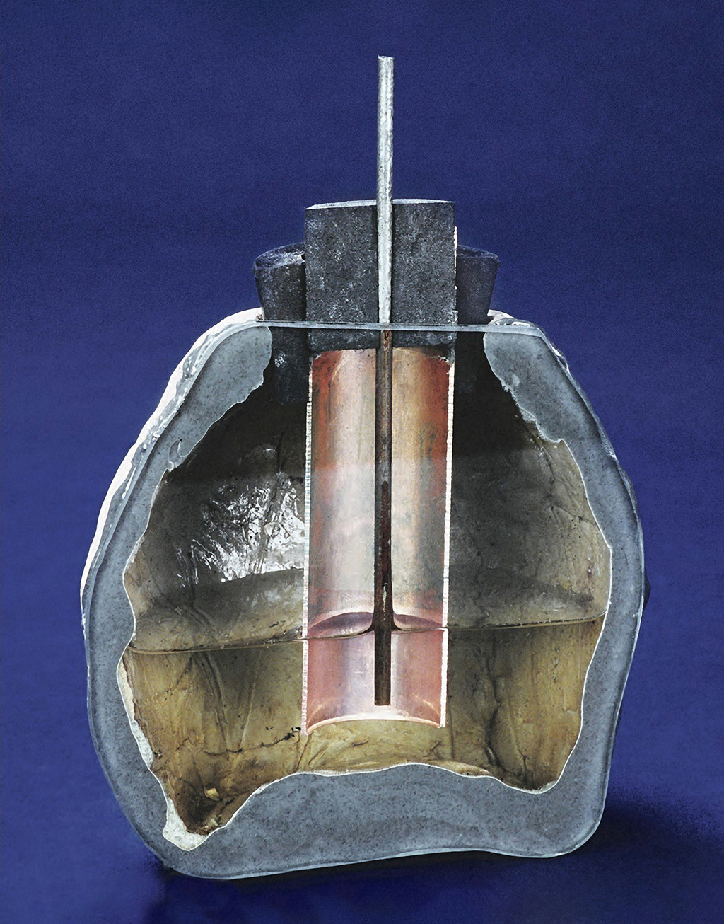 Baghdad Battery | Attention Deficit Disorder Prosthetic Memory Program