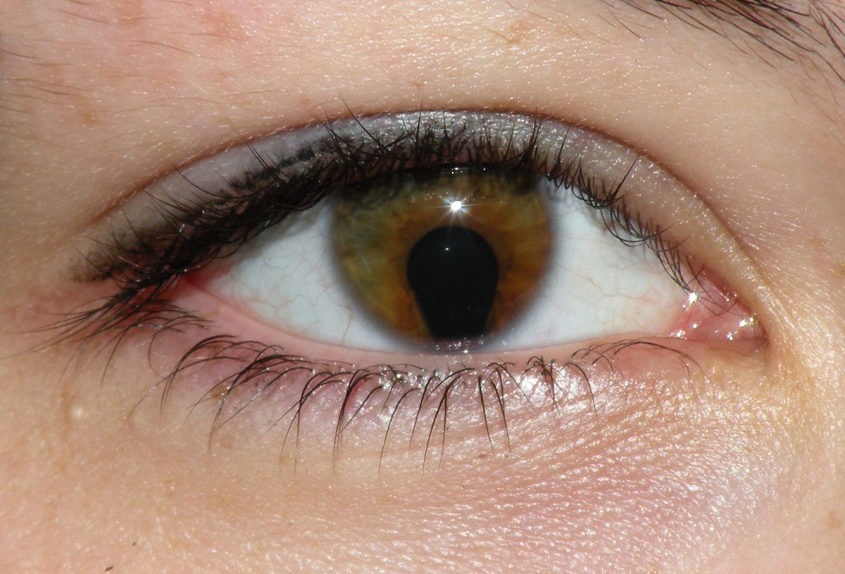 Coloboma | Attention Deficit Disorder Prosthetic Memory Program