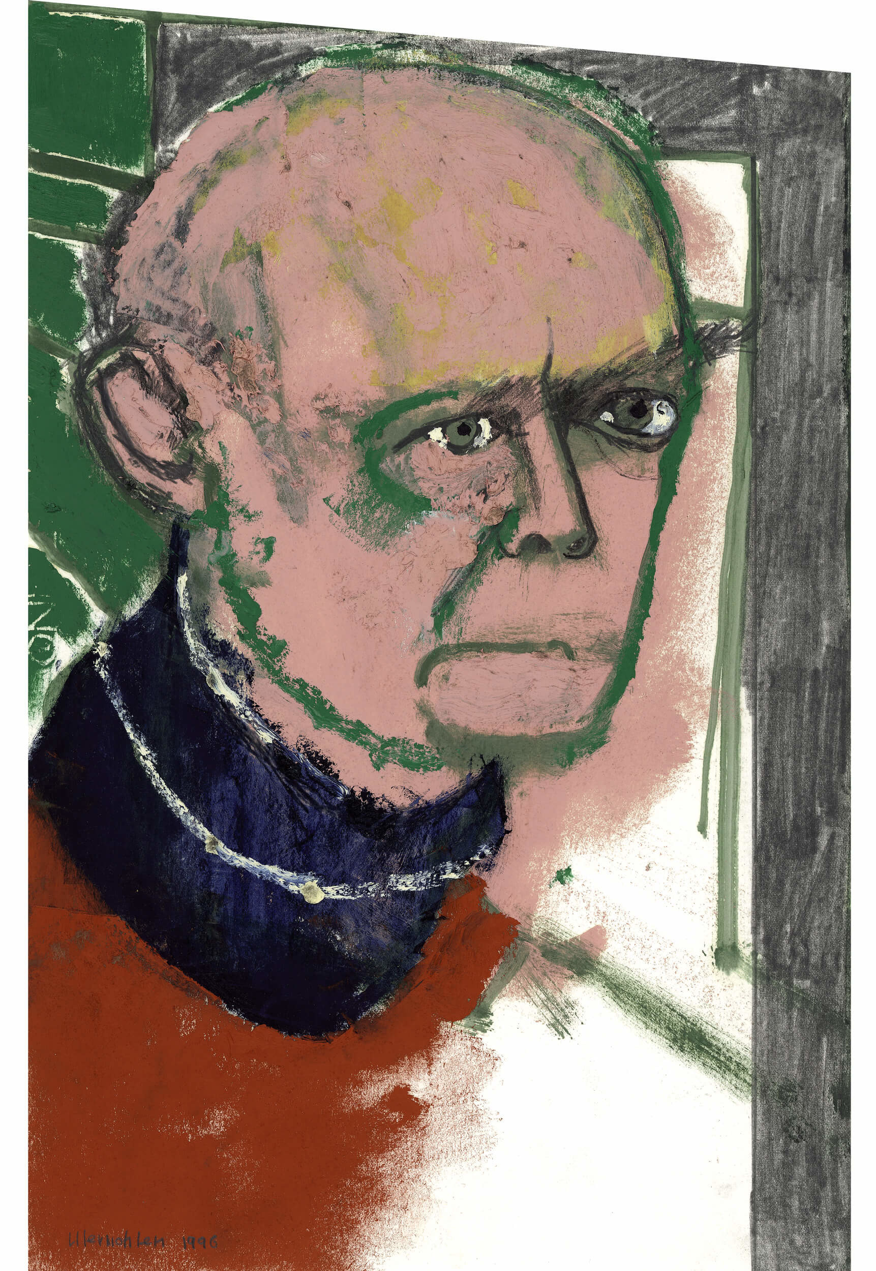 William Charles Utermohlen | Attention Deficit Disorder Prosthetic ...