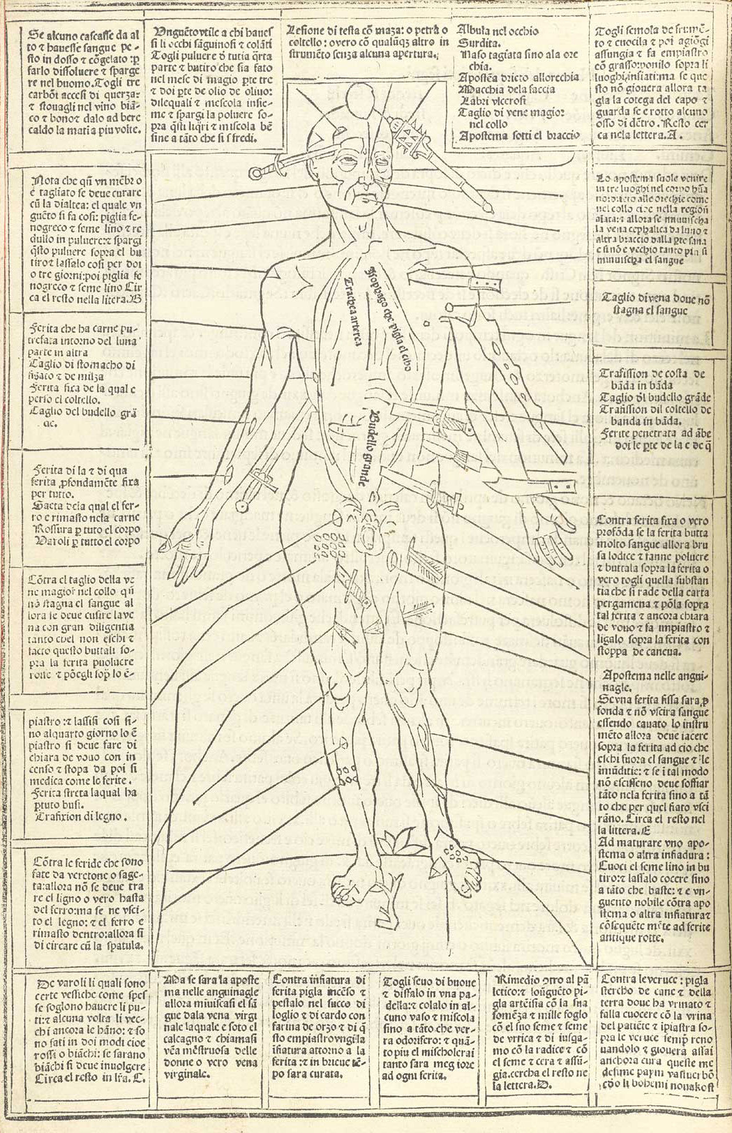 Wound Man | Attention Deficit Disorder Prosthetic Memory Program